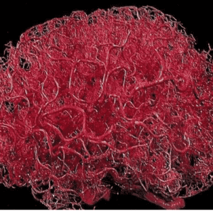 Post Traumatic Amnesia | Memory Loss Causes, Symptoms From Brain Injury